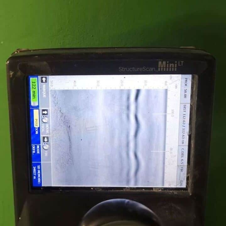 Le Ferroscan, tout ce qu'il faut savoir